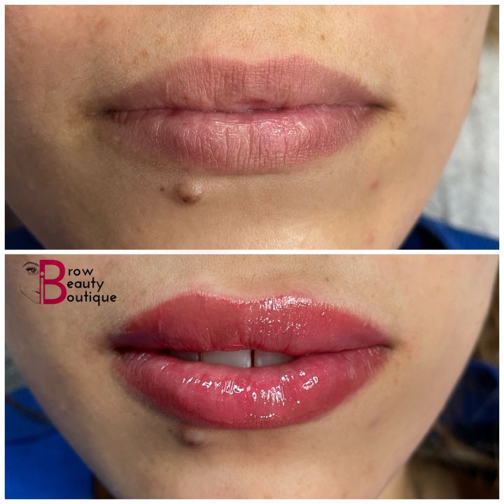 EVERYTHING YOU NEED TO KNOW ABOUT LIP BLUSHING - iBrow & Beauty Boutique